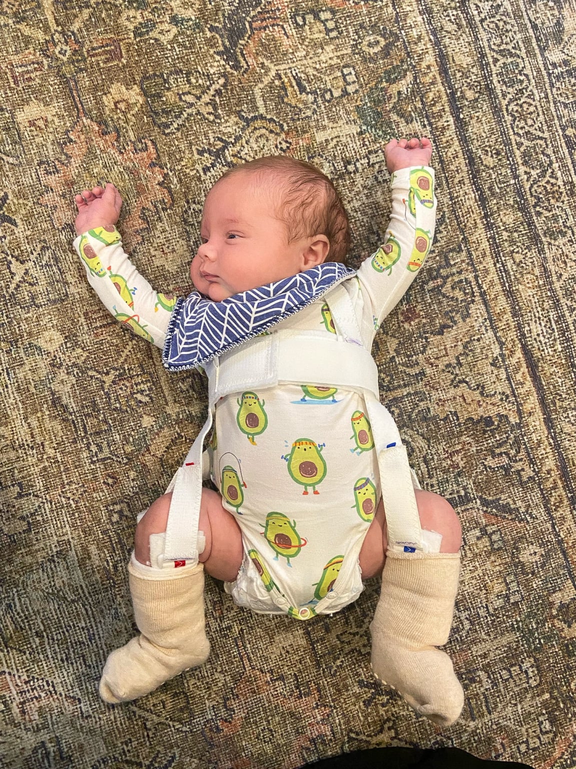 Tips for Infant Hip Dysplasia + The Pavlik Harness | The DIY Playbook